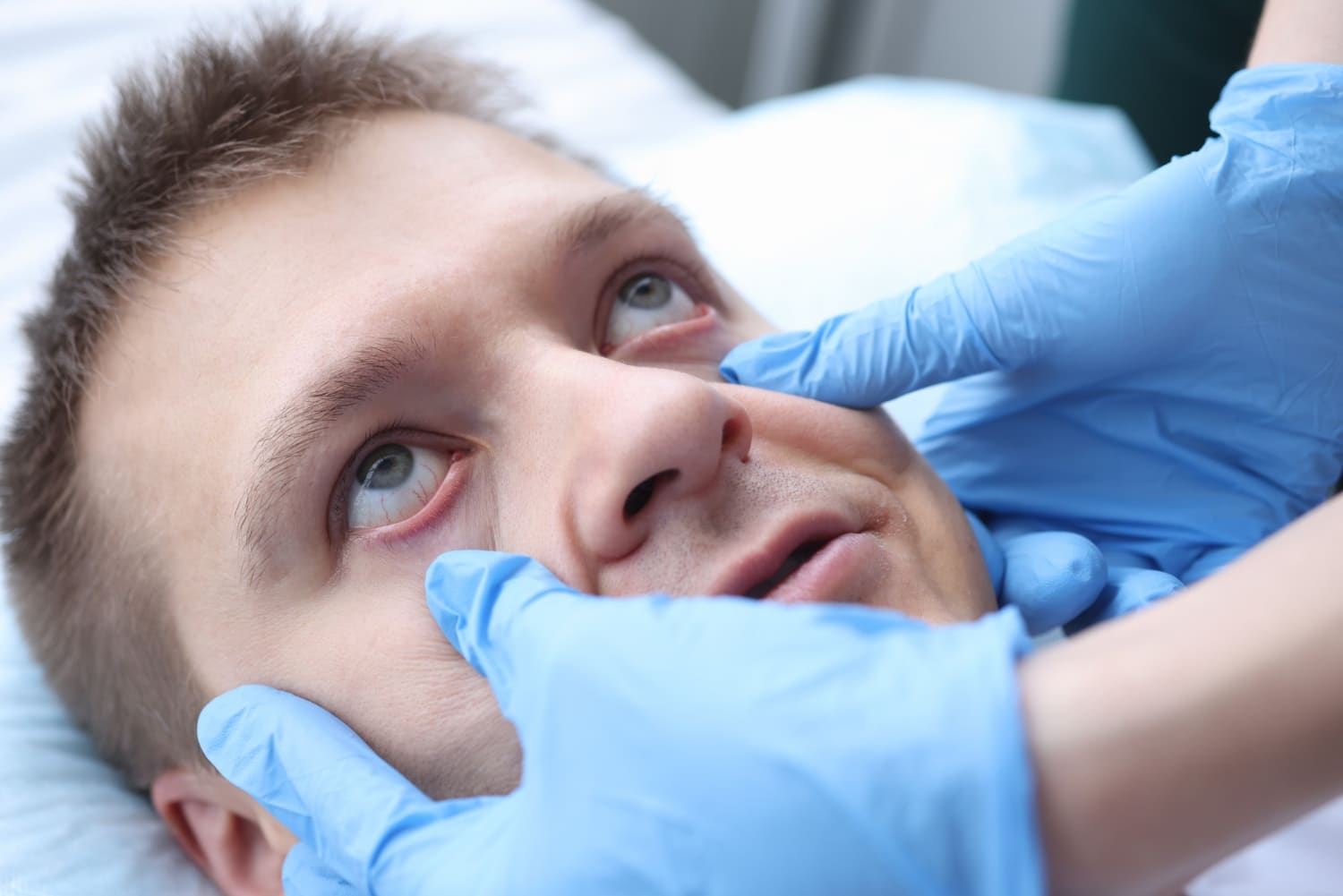 Czym jest żółtaczka i jakie są jej objawy? Czy żółtaczka jest zaraźliwa ...